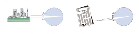 RGP Multifocal Contact Lenses - Evershine Optical