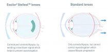 Essilor Stellest Lens - Evershine Optical
